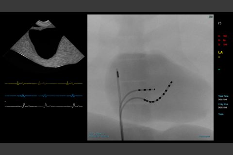 Angio Mentor Suite II - Endovascular access | More Than Simulators