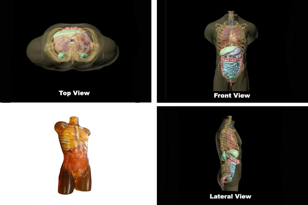 ADULT TORSO FOR ULTRASOUND TRAINING | More Than Simulators
